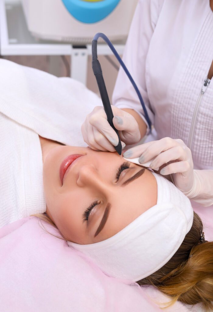 Thermocoagulation - Institut d'esthétique Mélanie Drouin